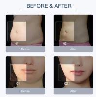 China 2024 Newest Endolaser 1470nm 980nm Diode Laser Face Lifting Liposuction Machine for sale