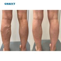 China 980+1470nm Laser Devices Mini Invasive Endovenous Laser Varicose Vein Surgery for sale