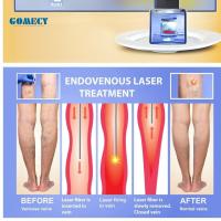 China EVLT Varicose Vein Removal Machine Radial Fiber Laser EVLT Endovenous Ablation Treatment Machine for sale