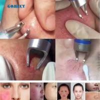 China 1470nm 980nm Diode Laser Veins Removal Machine Vascular Surgery Instruments for sale