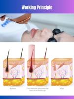 China 755 808 1064nm OEM Diode Laser Hair Removal Device for Ozero Khanka Pioneer for sale
