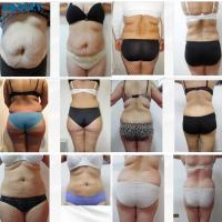 China 2025 Body Shape 6D Lipo Laser Slimming Machine Fats Removal 635 Slim Weight Loss for sale