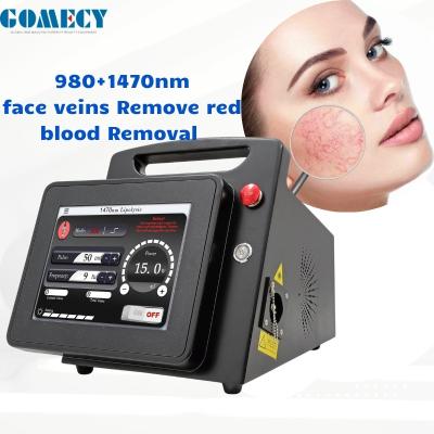 China 1470nm Laser Lipolysis Machine Submental 980nm Liposuction Neck Jowls Nasolabial Endo Face Lifting for sale