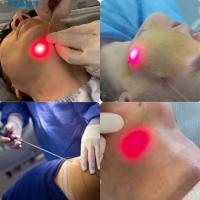 China Endolift 980NM 1470NM Diode Lase Double Wavelength Professional Liposuctio Device Face Lifting Dissolving Lipolysi Beaut Machine for sale