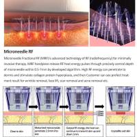 China 2 PCS Nano-L RF Heads Microneedle RF Device for Effective Face Lifting and Wrinkle Reduction Beauty Treatment for sale