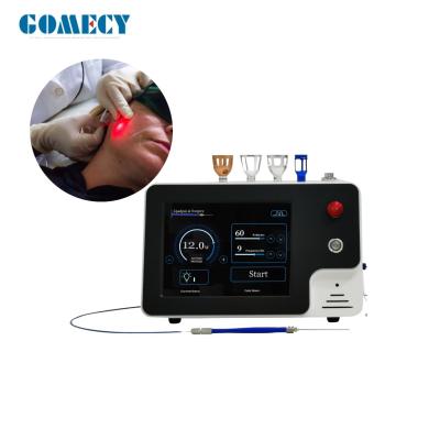China 1470nm 980nm Diode Laser Lipolysis Fat Removal Slimming Endolaser Endolifting Vascular Removal Endolift Laser Machine Price for sale
