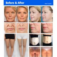 China Multifunction Body Slimming RF Device Infrared Laser Vacuum RF Beauty Machine Cavitation RF Fat Reduction Device for sale