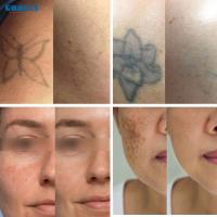 China 6 Optional Heads Carbon Peeling Picosecond Laser Treatment Skin Rejuvenation Tattoo Removal Machine for sale