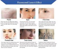 China Carbon Laser Tattoo Removal Machine Pico Laser Spectra Q Switched Nd Yag Laser Picosegundos Picocare Lutron Pico Machine Price for sale