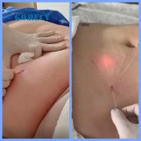 China 980nm 1470nm 635nm Endolift Laser Machine for sale