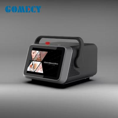 China 3 Waves Latest Design 635nm 980nm 1470nm Endolift Laser Machine For Sale Pain Relief Veins Remove Nail Fungus Cure Endolift Face Lift Lipolysis Fat Loss for sale