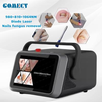China Gomecy ODM OEM Medical Grade Diode Laser 635nm Healing 980nm 1470nm Anti Inflammation Body Therapy Surgical Equipment for sale