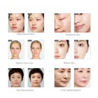 China Professional Aqua Peel Machine Deep Cleansing Hydro Dermabrasion Skin Rejuvenation Device for Beauty Salon for sale