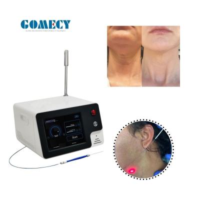 China 2025 Portable 1470nm+980nm Laser Lifting Fat Reduce Beauty Equipment Liposuction Endolaser Lifting1470Nm 980Nm Lipolysis for sale