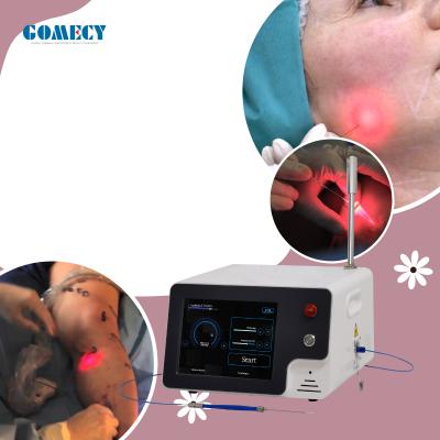China 980nm 1470nm 635nm Triple Wavelength Diode Laser Vascular Fat Skin Rejuvenation for sale