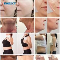 China 3 in1 Coldwave Shaping Device Face Lifting Body Contouring Skin Analysis Device for sale