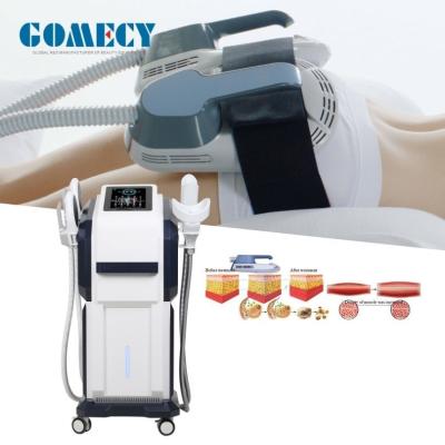 China 360° Semiconductor Surround Cooling Cryolipolysis Slimming Machine with 7 Tesla HI-EMT Muscle Stimulation and 0℃ to -11℃ Adjustable Cooling for sale