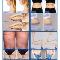 China Cold Wave Slimming Machine Combining Intelligent Energy Control with High Frequency Technology for Effective Results for sale