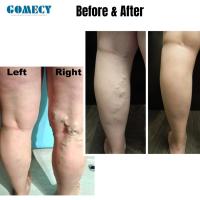 China 1940nm Advanced EVLT/EVLA Varicose Vein Surgical Laser Electricity Air Cooled for Phlebology for sale