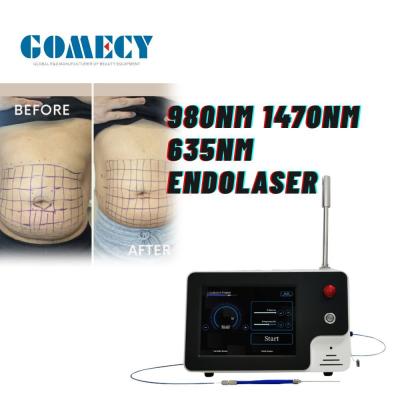 China Professional Endolaser Liposuction System-980 1470nm Dual Wavelength Diode Laser 30W Air Cooling for Body Contouring for sale