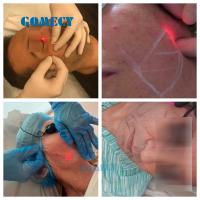 China Portable Desktop Endolaser Machine 980nm 1470nm Diode Lasers for Skin Tightening Face Lifting Liposuction Lipolysis for sale