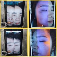 China Complete Skin Analyzer Including A Scalp Analysis Handpiece A Large Screen And A High-Definition Camera for sale