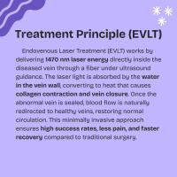 China 980nm 1470nm 635nm Triple Wavelength EVLT Diode Laser System 30W Endovenous Vein Treatment Machine for Varicose Vein Surgery for sale
