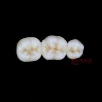 China Polished Glazed Zirconia Reduced Plaque Accumulation Clinical Friendly Design for sale
