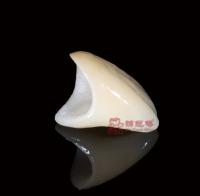 China Polished Glazed Zirconia Reduced Plaque Accumulation Clinical Friendly Design for sale