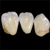 China Customized Dental Crown and Bridge Porcelain Fused to Zirconia with CE FDA Certification and 3D Laser Printing for sale