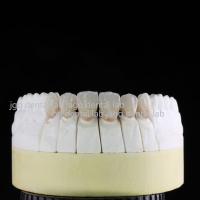 China Dental Pfm Crown And Bridges Pontic Dentures Materials Dental Restorations for sale