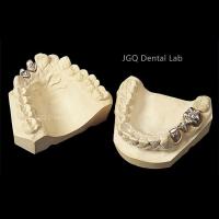 China Dental Pfm Crown And Bridges Pontic Dentures Materials Dental Restorations for sale