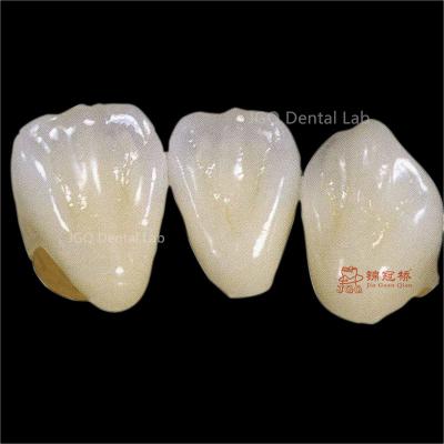 China Polished Glazed Zirconia Reduced Plaque Accumulation Clinical Friendly Design for sale
