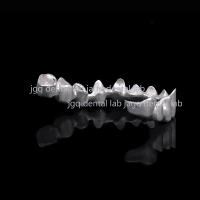 China Dental Alloy Metal Ceramic Crown Dental Restoration Porcelain Fused Metal Teeth for sale