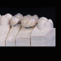 China Dental Alloy Metal Ceramic Crown Dental Restoration Porcelain Fused Metal Teeth for sale