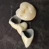 China Dental Alloy Metal Ceramic Crown Dental Restoration Porcelain Fused Metal Teeth for sale