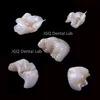 China Digital Empress Onlay And Inlay Customized By Dental Prosthesis Laboratory for sale