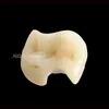 China Digital Empress Onlay And Inlay Customized By Dental Prosthesis Laboratory for sale