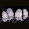 China Customized Chinese Dental Lab Zirconia Teeth Precision Overall Dental Restoration for sale