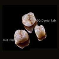 China Customized Chinese Dental Lab Zirconia Teeth Precision Overall Dental Restoration for sale
