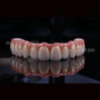 China Titanium Abutment Dental Implant Screw Retained Crown 3D Laser Printing Customized for sale