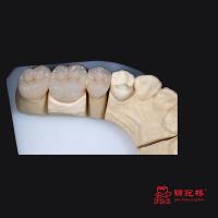 China China Dental Artificial Teeth Pfm Dental Metal Ceramic Crown Bridge Customized for sale