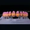 China Titanium Abutment Dental Implant Screw Retained Crown 3D Laser Printing Customized for sale