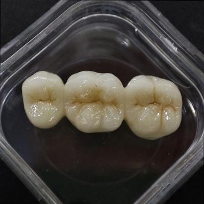 China Customized Specification Denture Products Zirconia Ceramic Crowns and Bridge with Fast Turnaround Time CE FDA Certified for sale