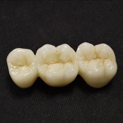China Customized Design Zirconia Dental Bridge with 3D Laser Printing and Fast Turnaround for sale