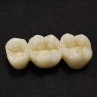 China Customized Design Zirconia Dental Bridge with 3D Laser Printing and Fast Turnaround for sale