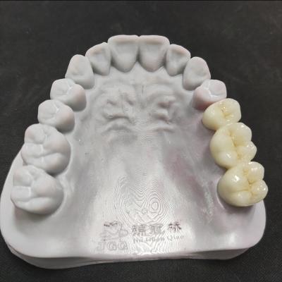 China Fast Turnaround 2-3 Days Customized Zirconia Ceramic Dentures CE FDA Certified Oral Restorations for sale