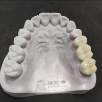 China Fast Turnaround 2-3 Days Customized Zirconia Ceramic Dentures CE FDA Certified Oral Restorations for sale