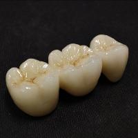 China Multilayer Shade Zirconia Ceramic Build up Dentures Crown and Bridge Dental Lab Supplies for sale