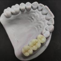 China Multilayer Shade Zirconia Ceramic Build up Dentures Crown and Bridge Dental Lab Supplies for sale